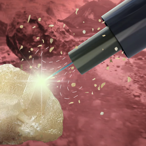 Innovex Flex-Tip Negative Pressure Ureteral Access Sheath (NP-UAS ...