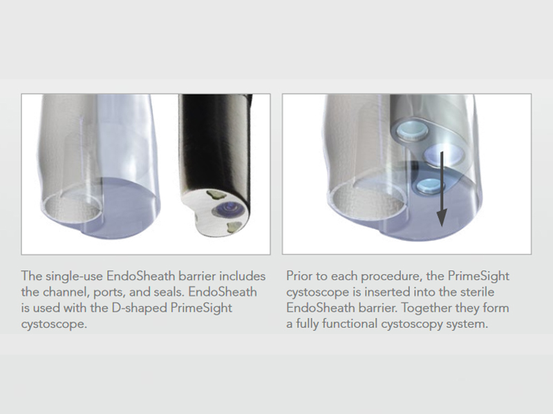 PrimeSight EndoSheath Sterile Cystoscopy - Endotherapeutics
